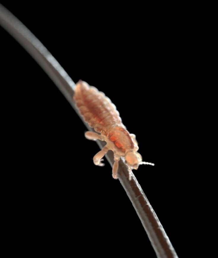 Lice 101: What They Are + How to Remove Them